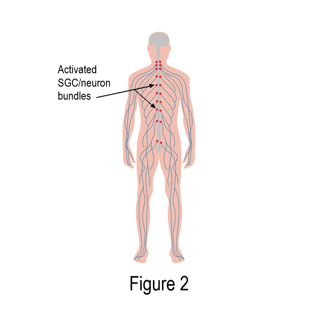 Is Fibro an Autoimmune Disease? - American Fibromyalgia Syndrome ...